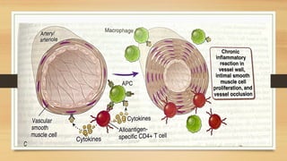 types of graft rejection seminar skin rejection | PPTX