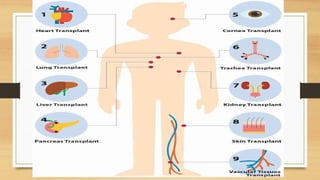 types of graft rejection seminar skin rejection | PPTX