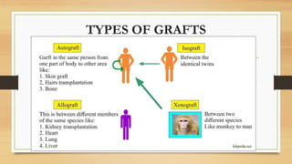 types of graft rejection seminar skin rejection | PPTX