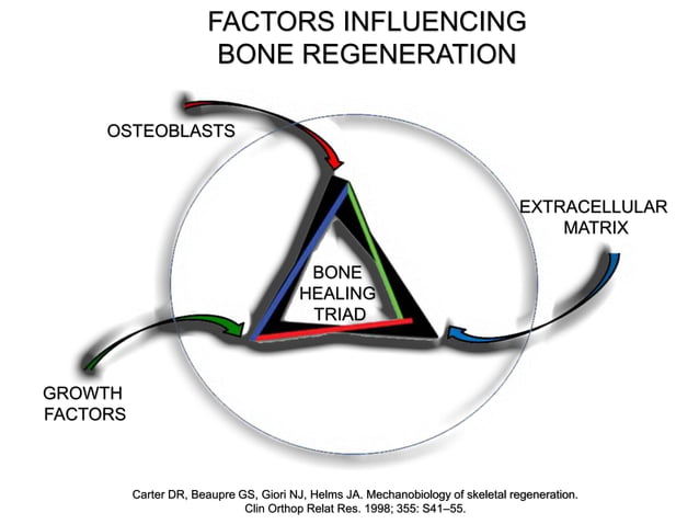 Osteogenic Potential of Bone Grafts | PPT