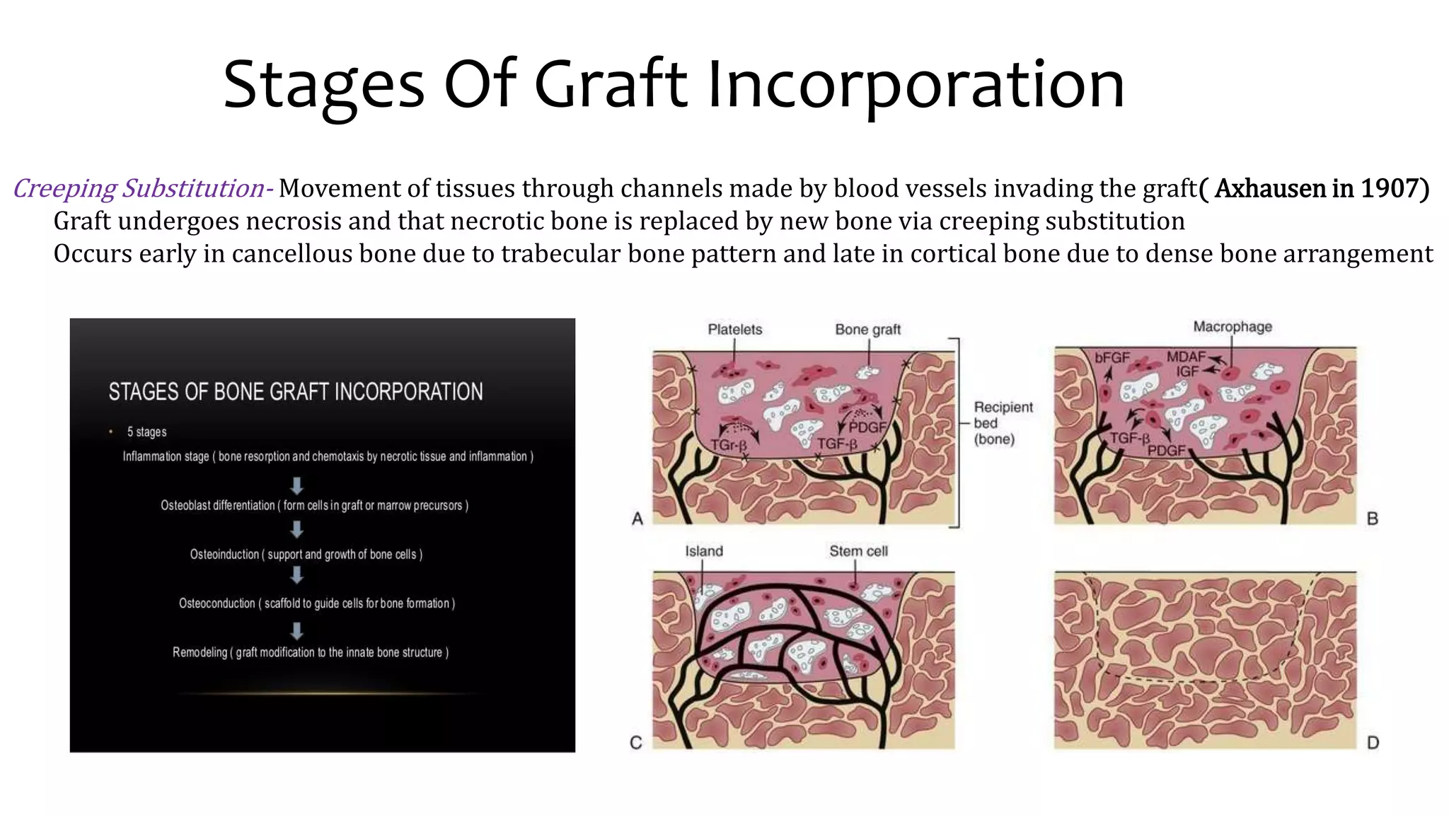 Grafts in oral and maxillofacial surgery | PPTX