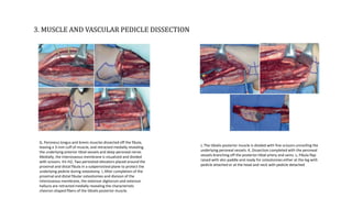 Grafts in oral and maxillofacial surgery | PPTX