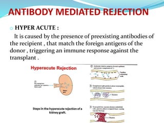 Graft verses host reaction and rejection | PPTX
