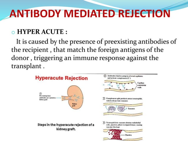 Graft verses host reaction and rejection | PPTX