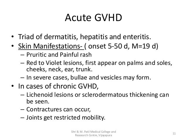 Graft versus host disease