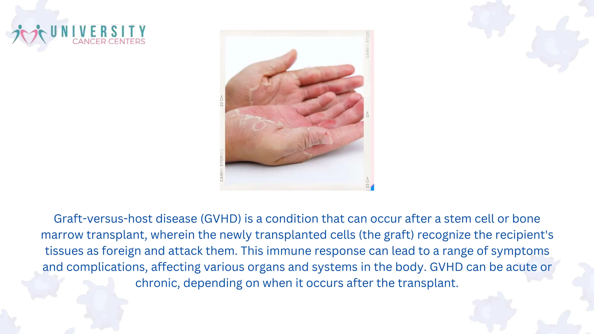 Graft Vs Host Disease | PPTX