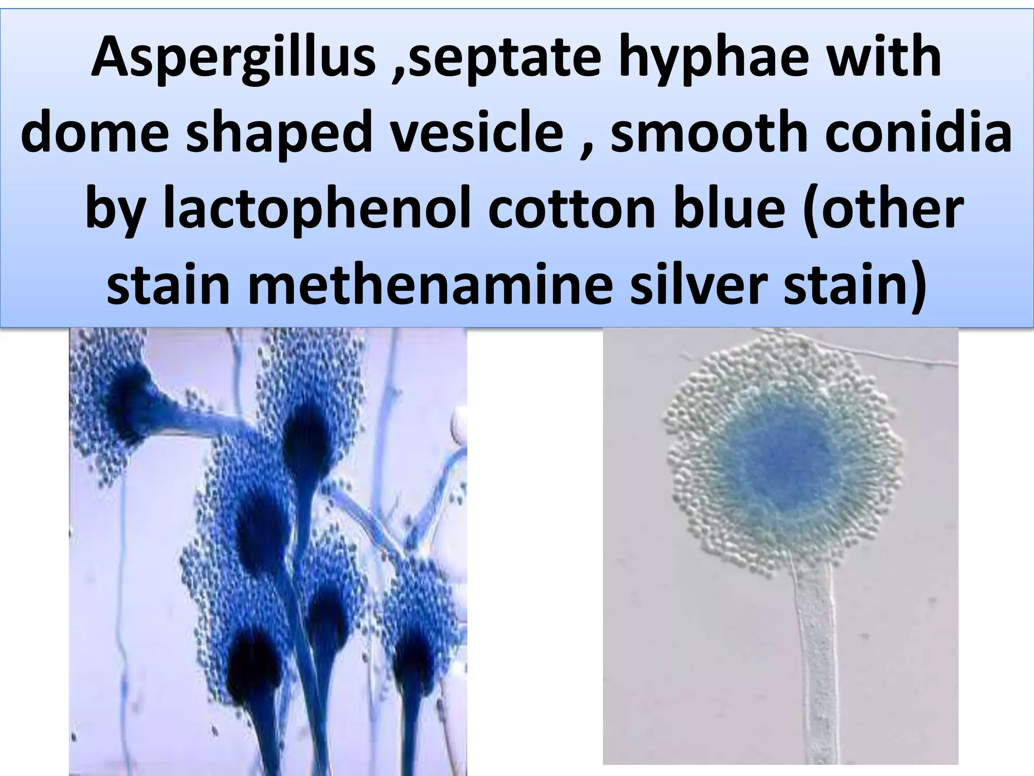 practical microbiology Gram staining | PDF