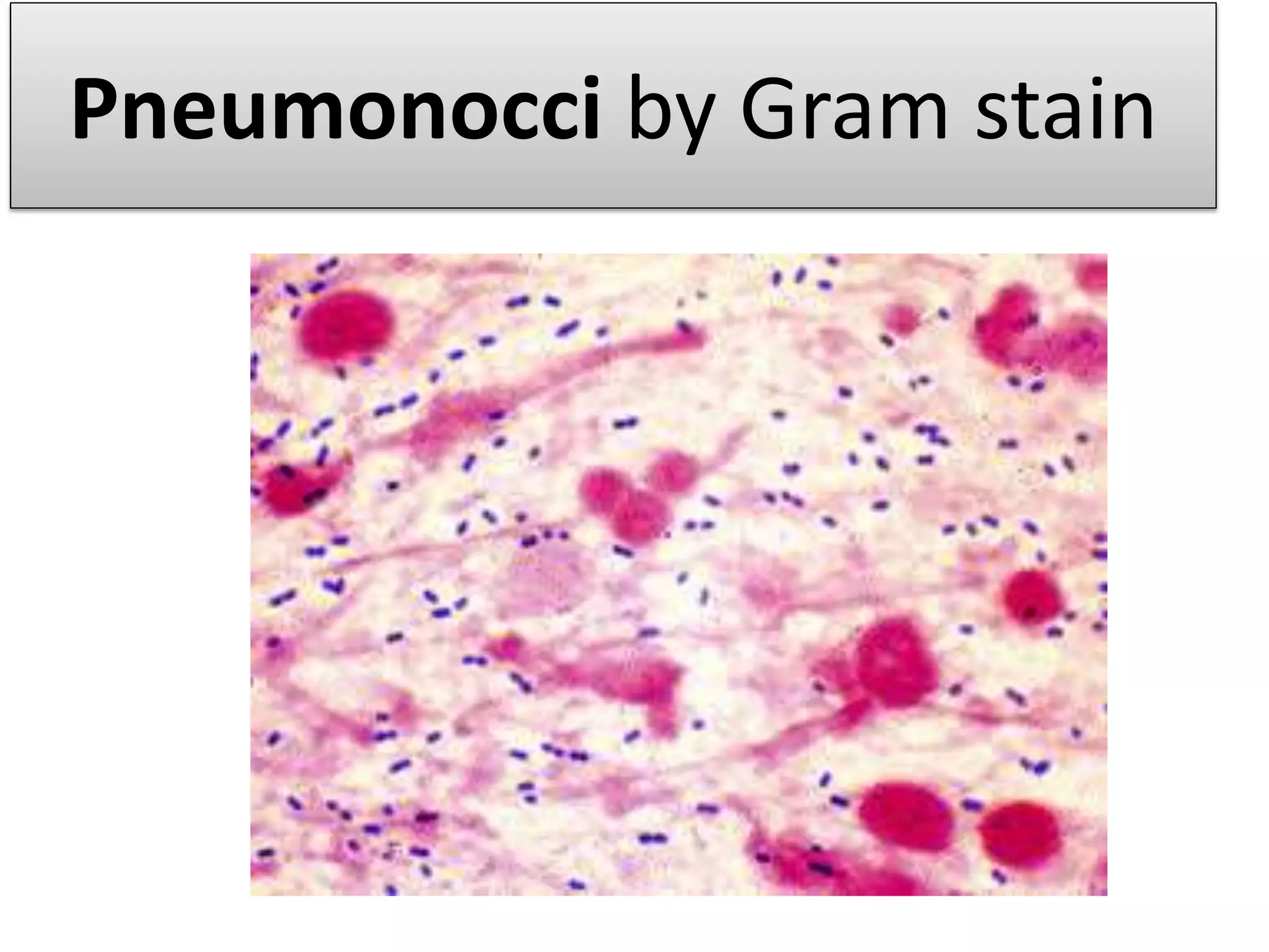 practical microbiology Gram staining | PDF