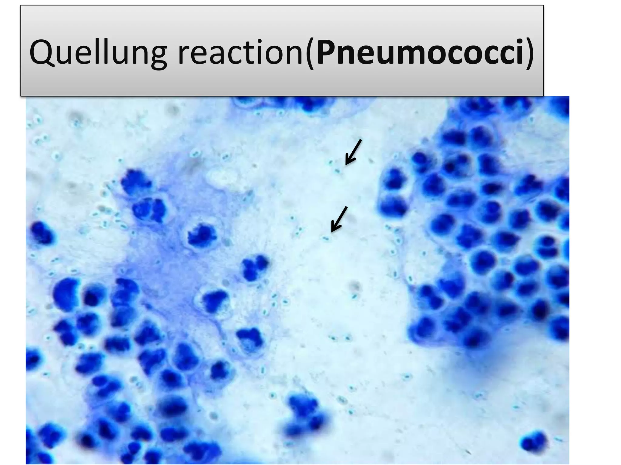 practical microbiology Gram staining | PDF