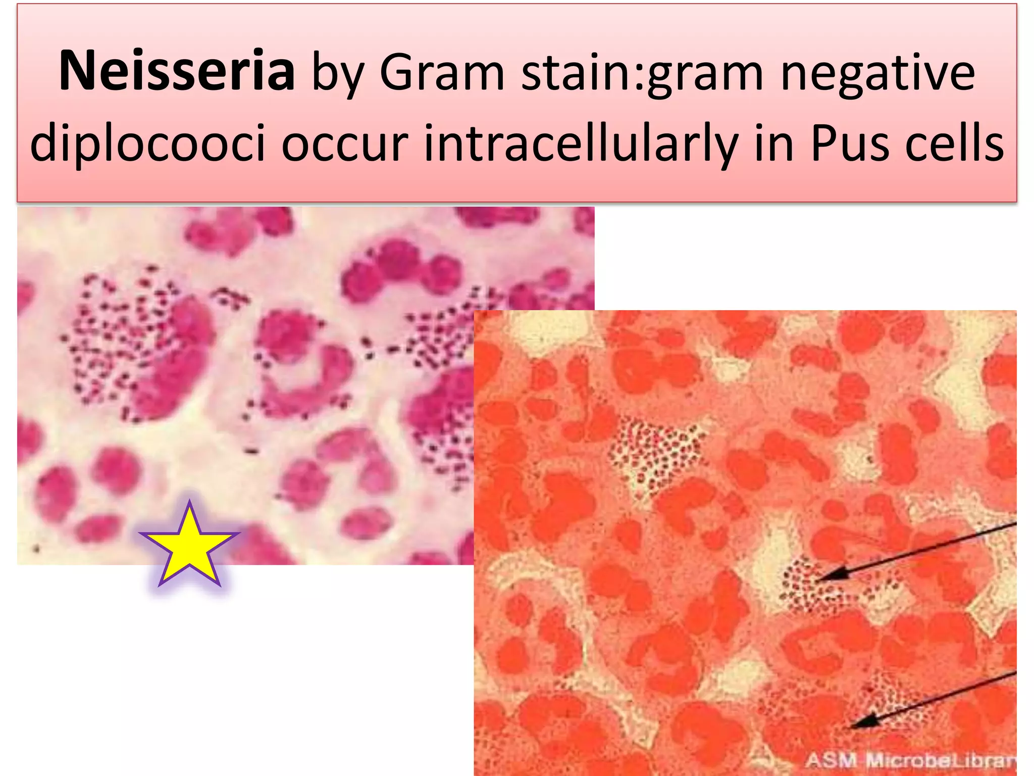 practical microbiology Gram staining | PDF