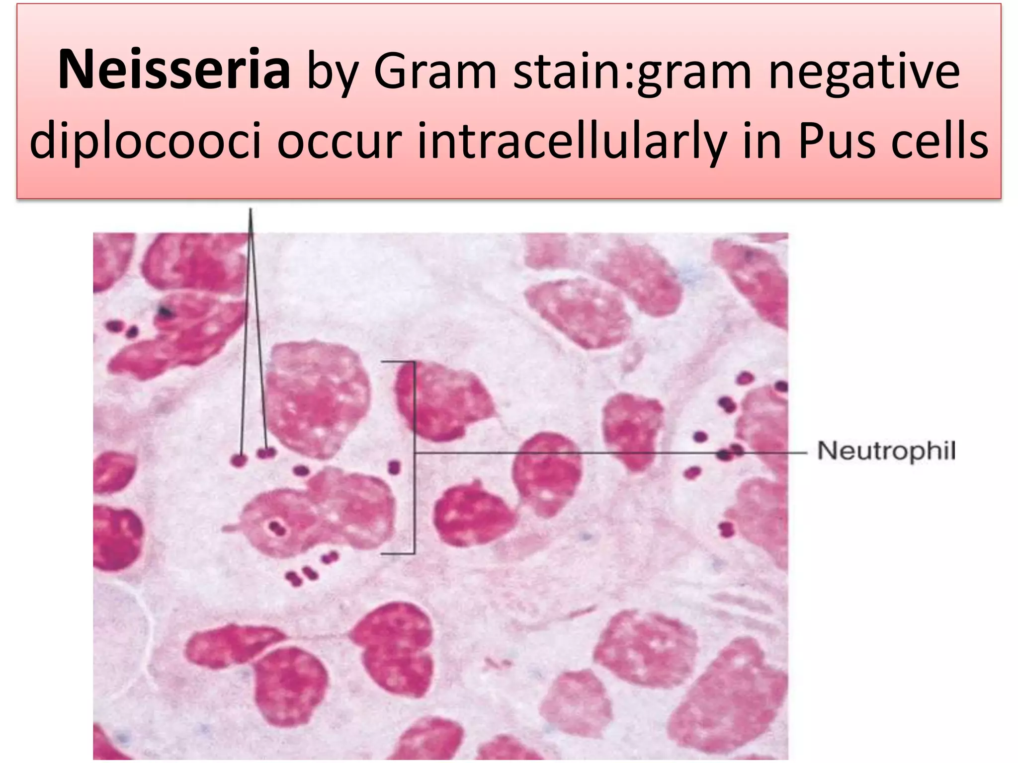 practical microbiology Gram staining | PDF