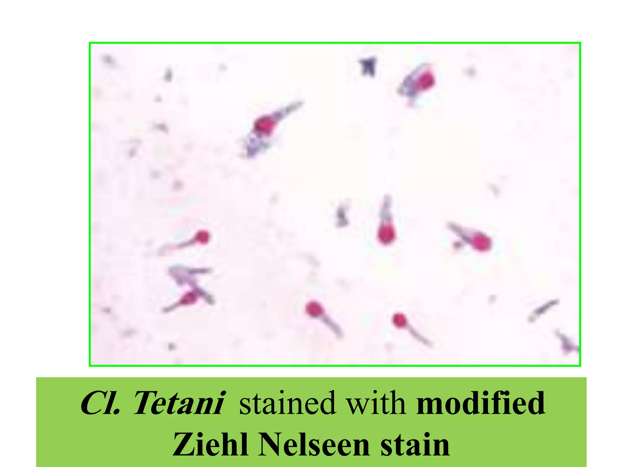 practical microbiology Gram staining | PDF