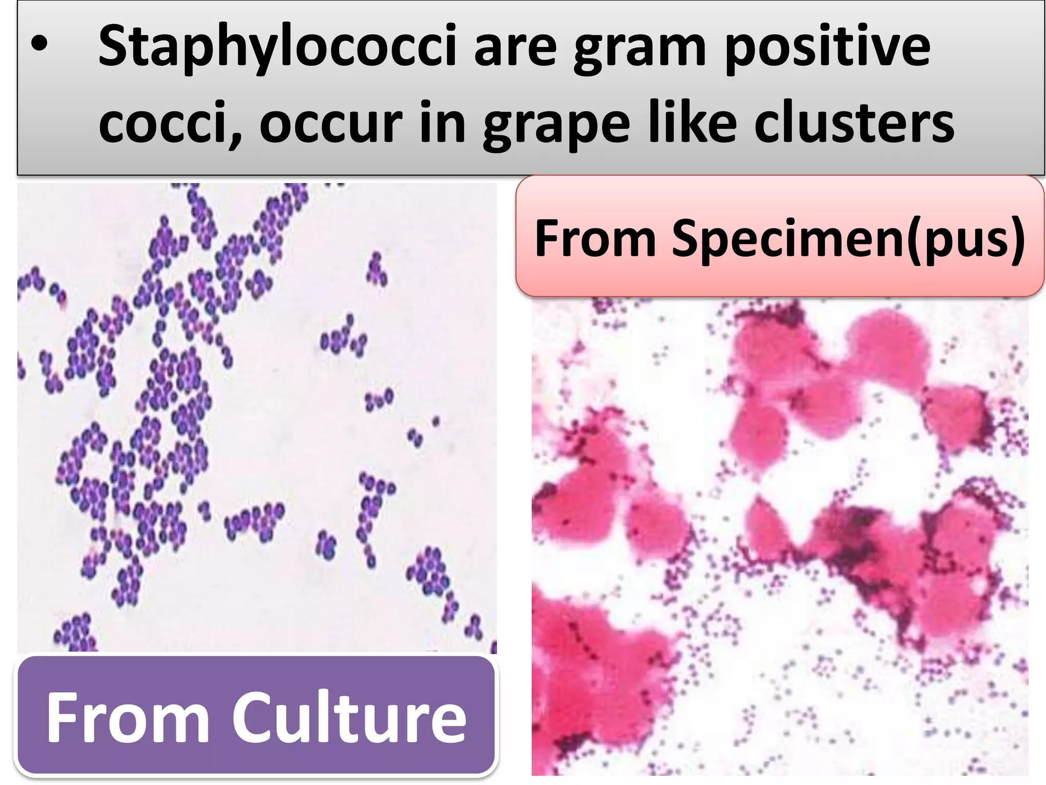 practical microbiology Gram staining | PDF