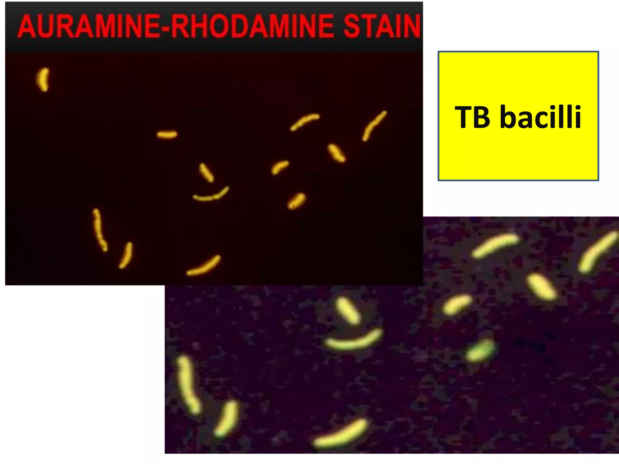 practical microbiology Gram staining | PDF