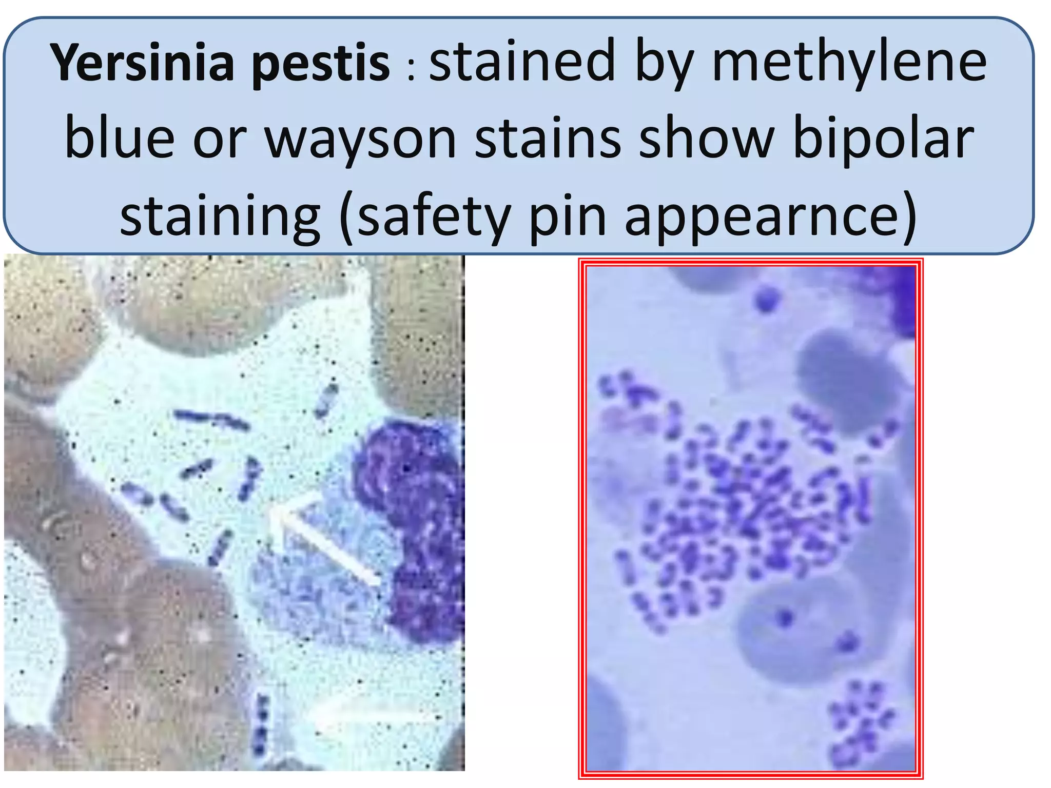 practical microbiology Gram staining | PDF