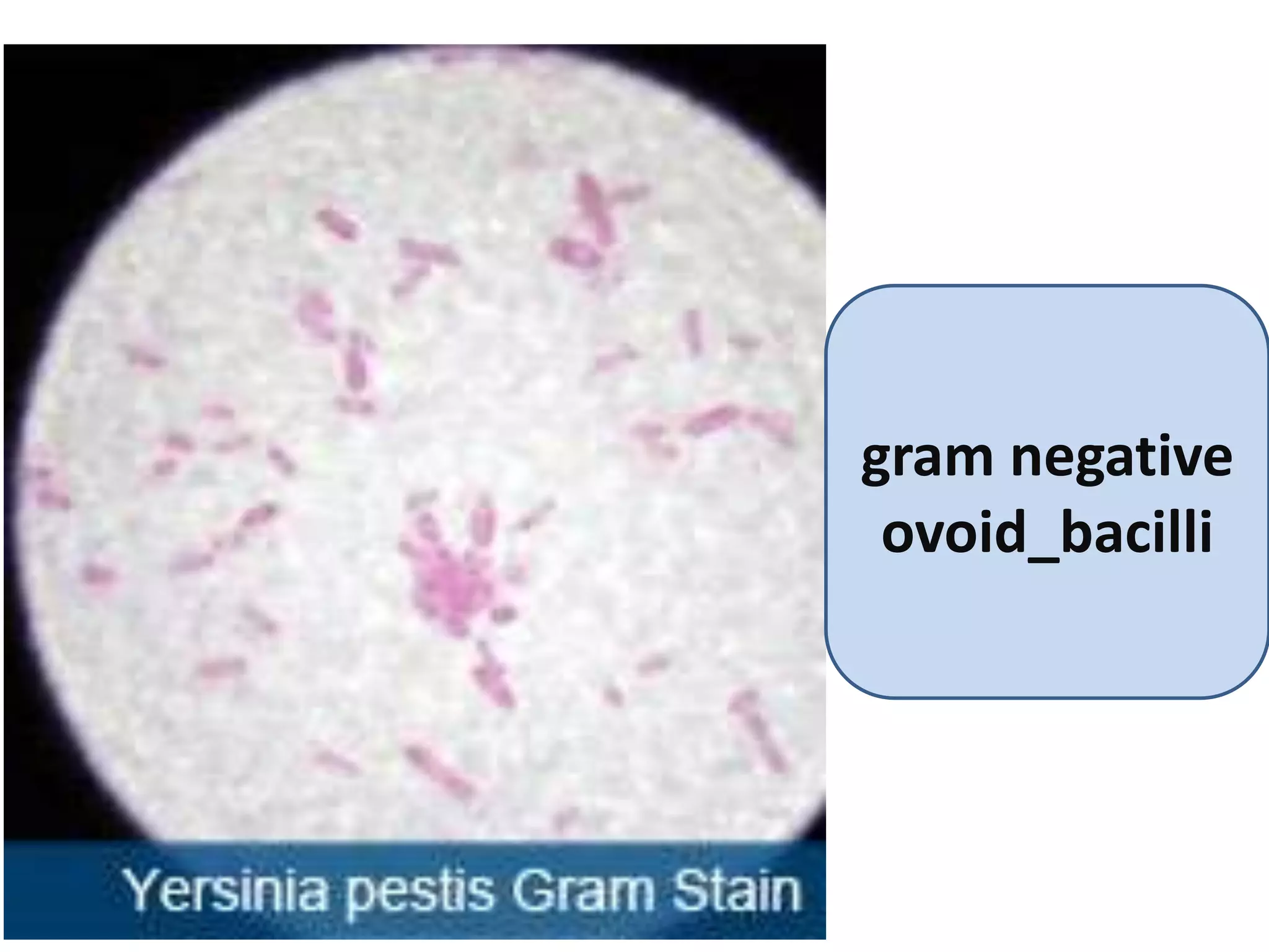 practical microbiology Gram staining | PDF