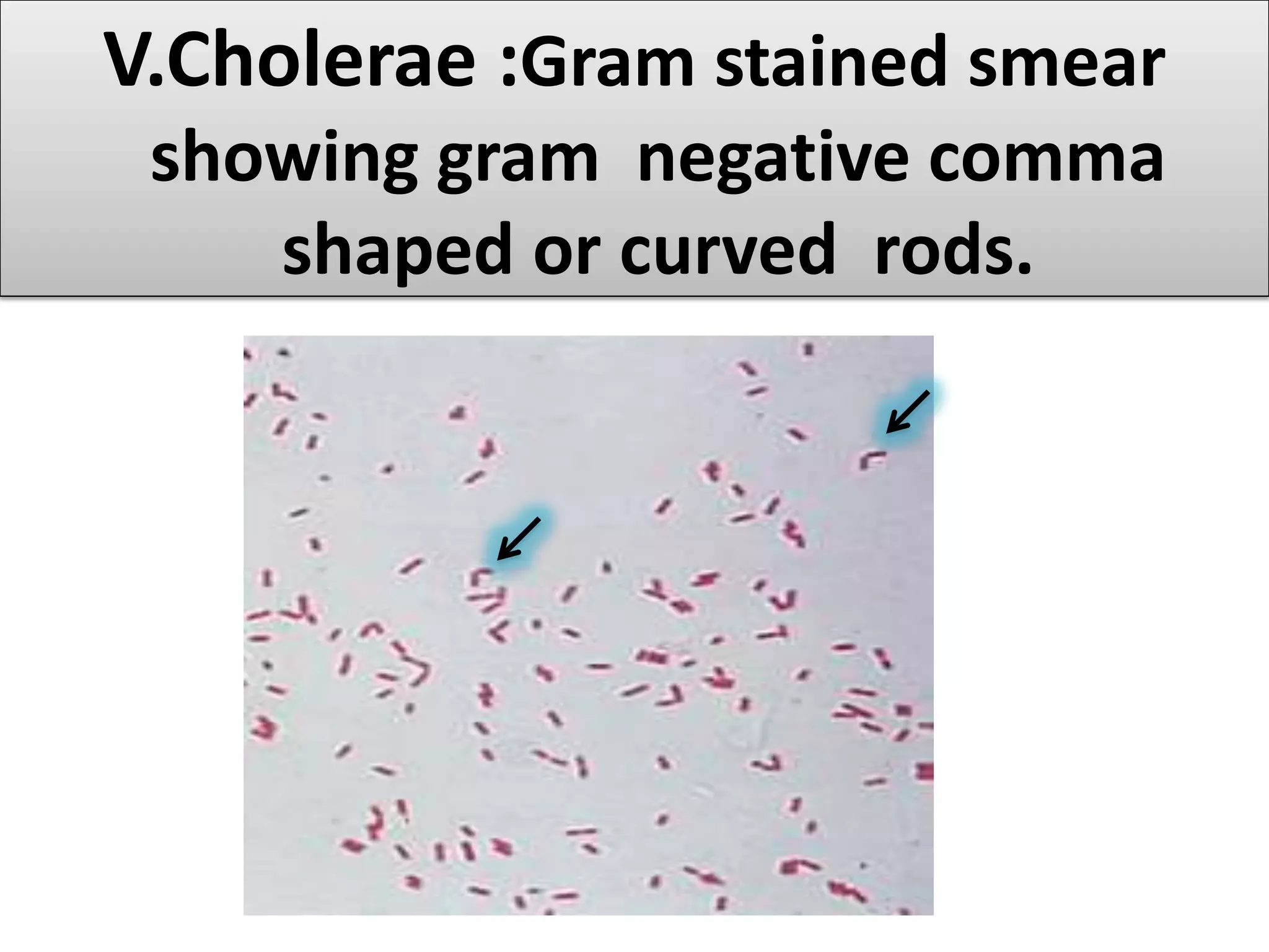 practical microbiology Gram staining | PDF