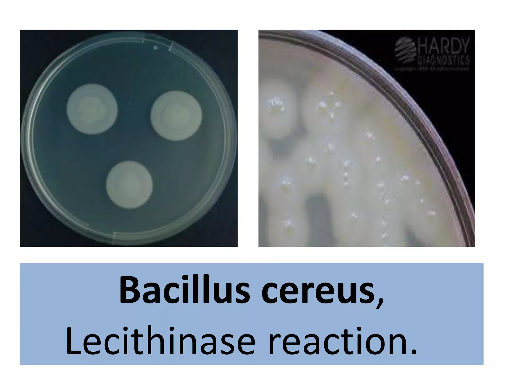 practical microbiology Gram staining | PDF