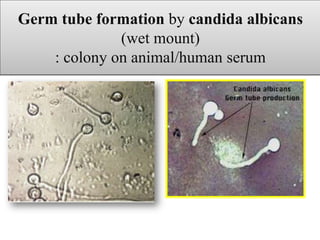 practical microbiology Gram staining | PDF