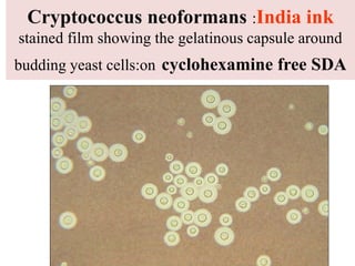 practical microbiology Gram staining | PDF