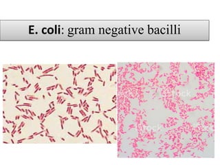 Gram Negative Diplobacilli