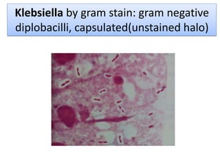 Gram Negative Diplobacilli