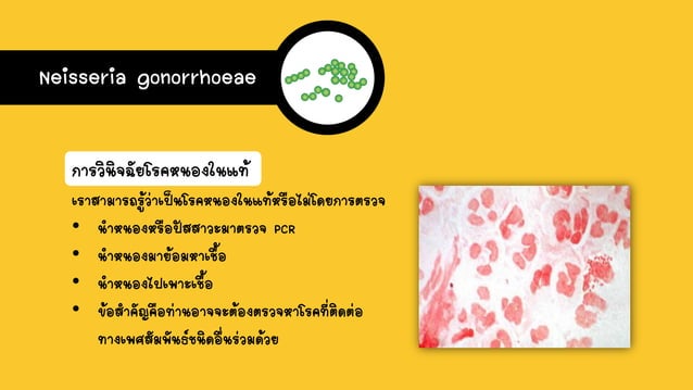 Gram-negative bacteria / oxidase positive | PDF