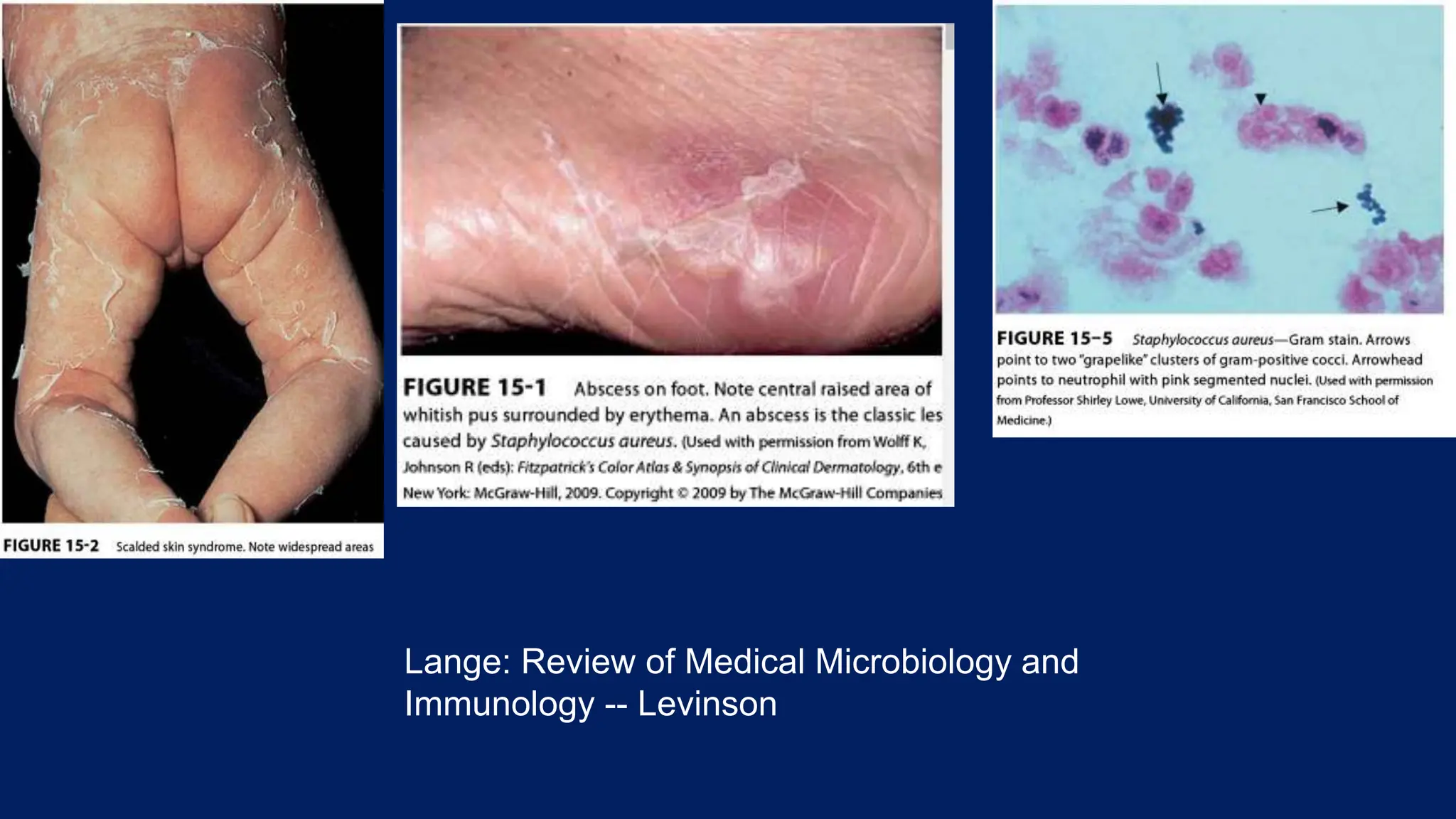 Gram Positive Bacterial Infections in Paediatrics | PPTX | Diseases and ...