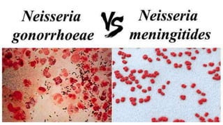 Gram negative cocci | PPTX