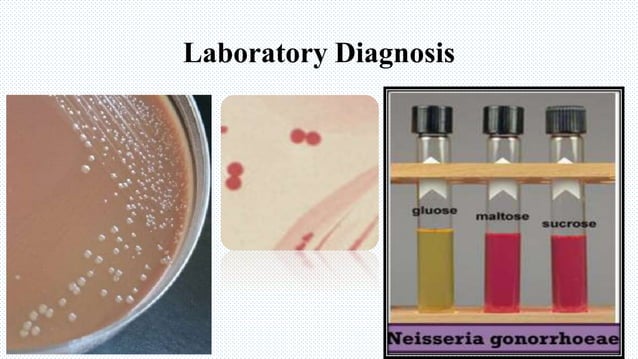 gram negative cocci.pptx | Infectious Diseases | Diseases and Conditions