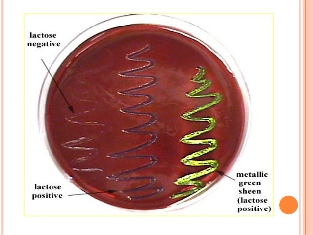 Gram negative rods