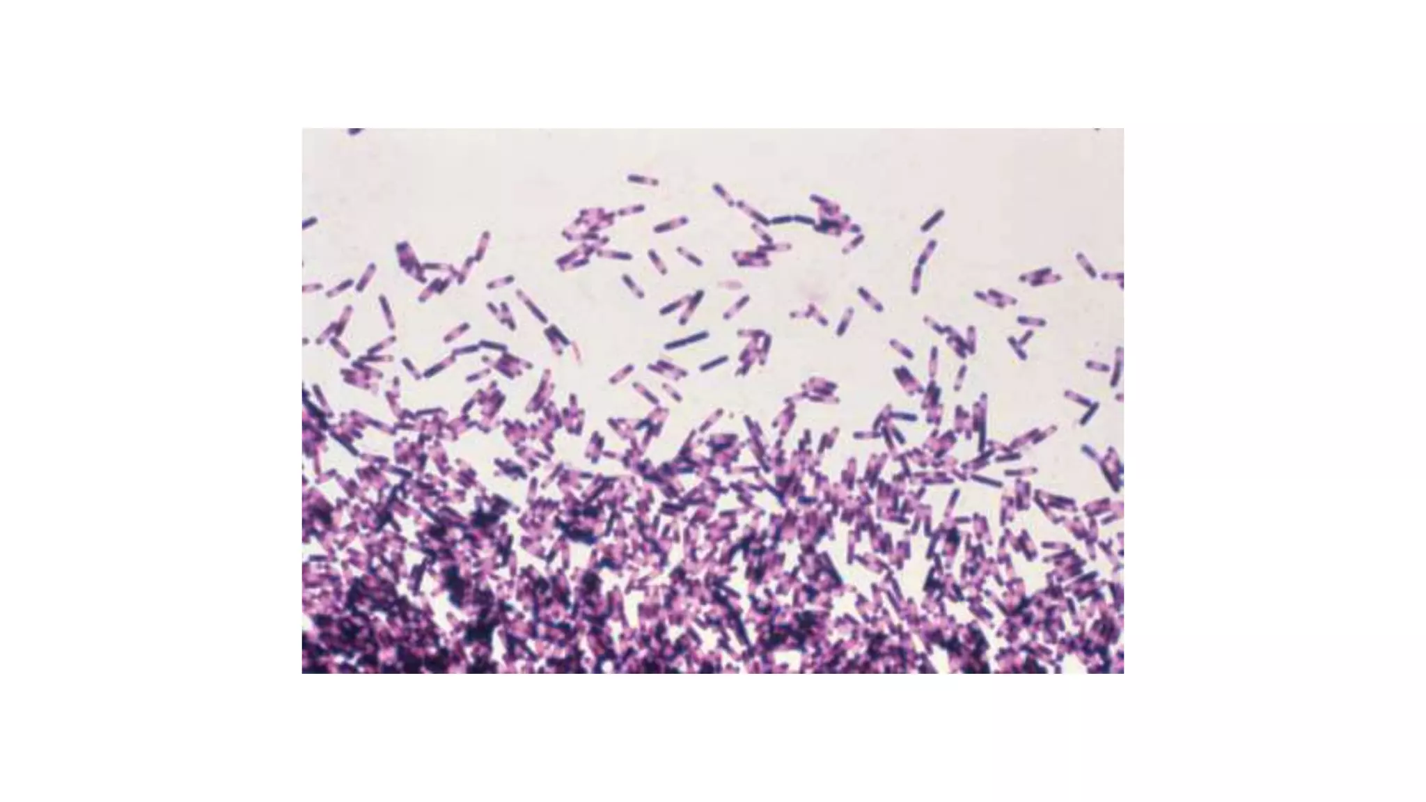 Anaerobic Gram-Positive Spore-Forming Bacilli | PPTX