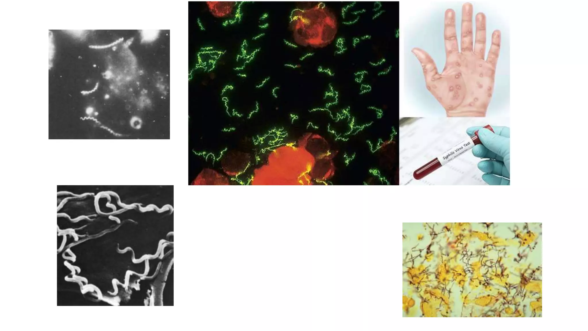 Anaerobic Gram-Positive Spore-Forming Bacilli | PPTX