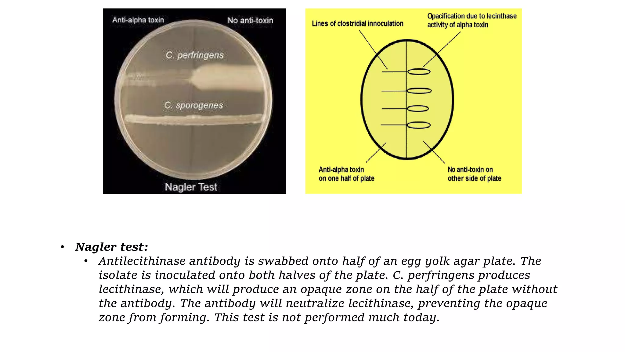 Anaerobic Gram-Positive Spore-Forming Bacilli | PPTX