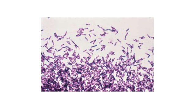 Anaerobic Gram-Positive Spore-Forming Bacilli | PPTX | Digestive ...
