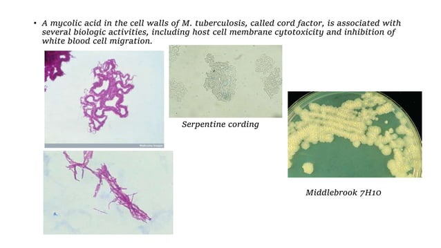 Anaerobic Gram-Positive Spore-Forming Bacilli | PPT