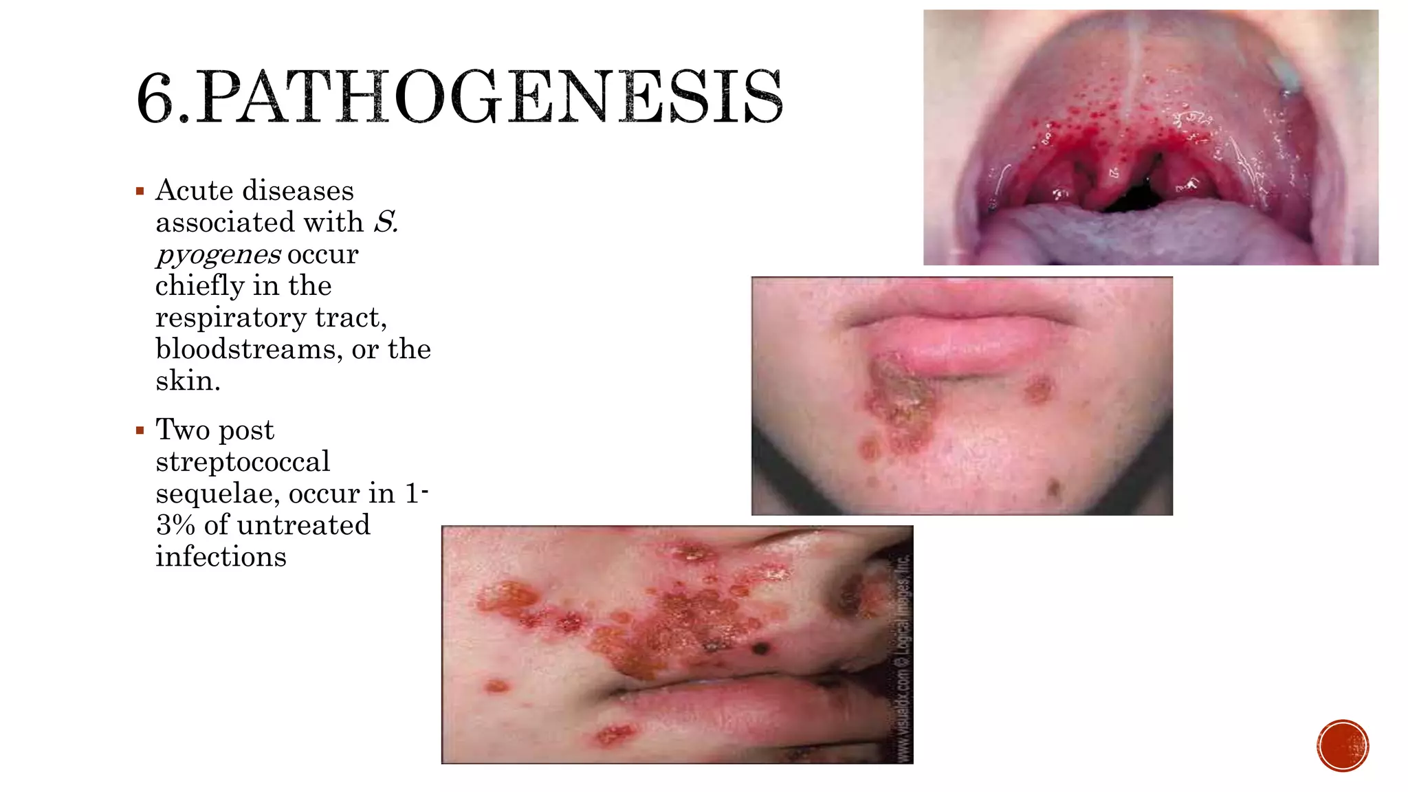 Gram Positive And Gram Negitive Bacteria Pptx
