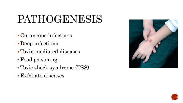 Gram Positive And Gram Negitive Bacteria Pptx