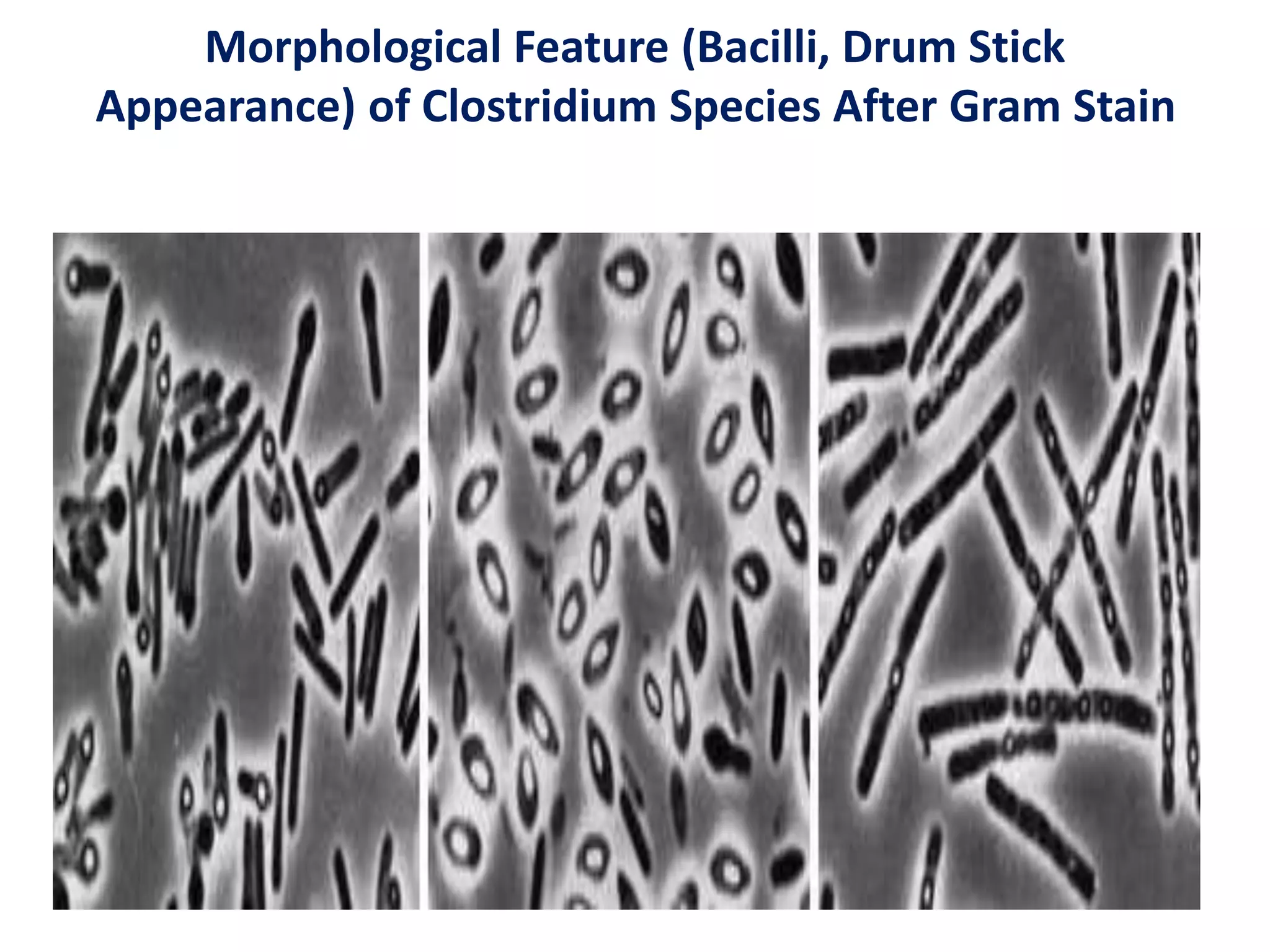 GRAM POSITIVE BACTERIA.pptx
