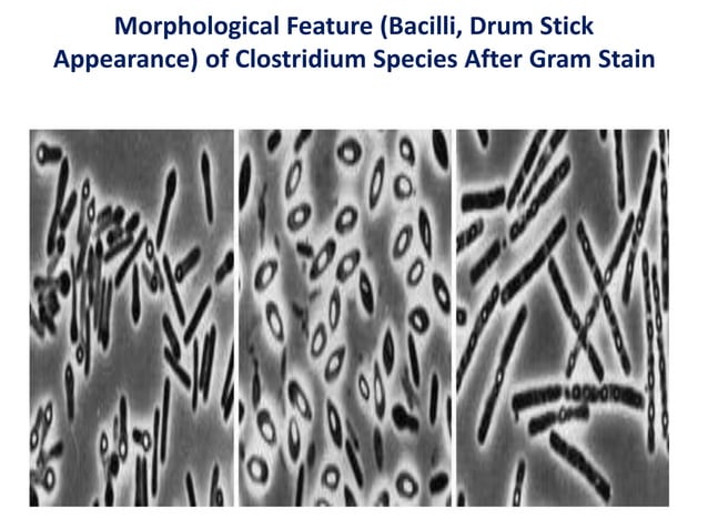 GRAM POSITIVE BACTERIA.pptx