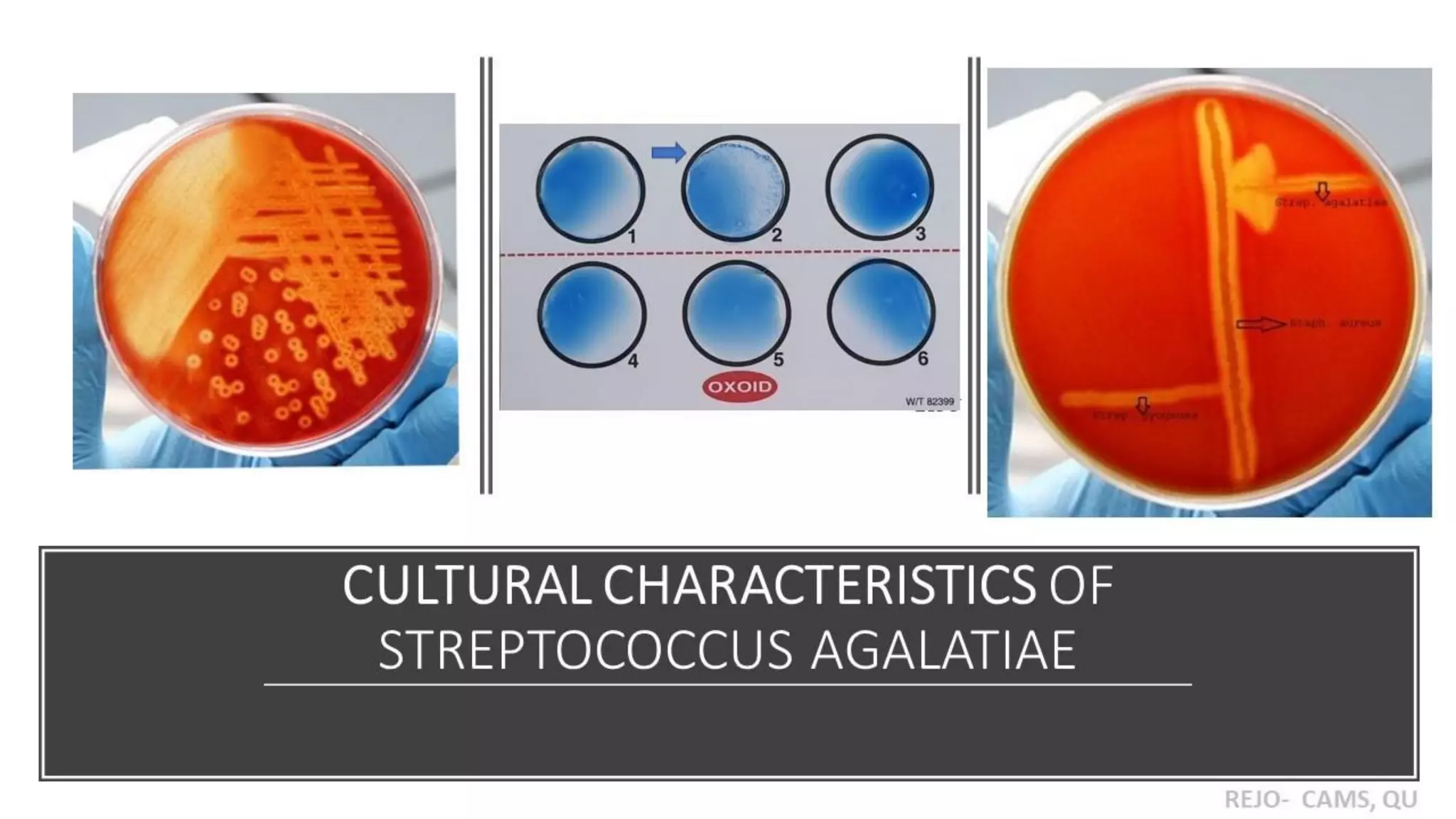 Gram positive cocci identification - Part 1 | PDF