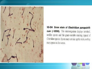 Clostridium Botulinum Gram Positive Stain