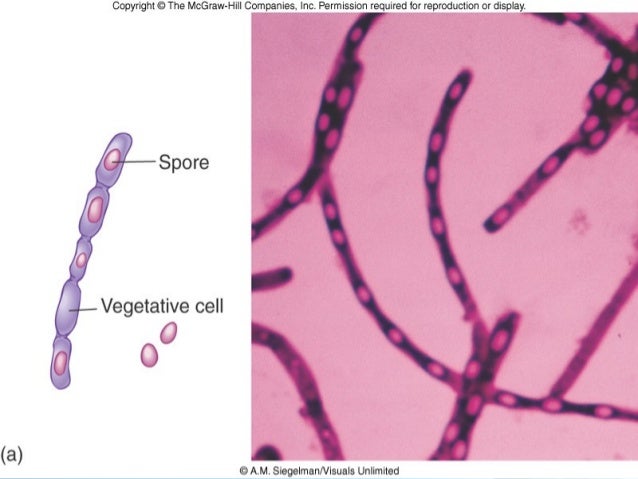 Gram positive rods