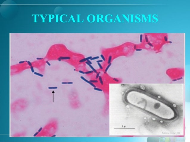 Gram positive rods