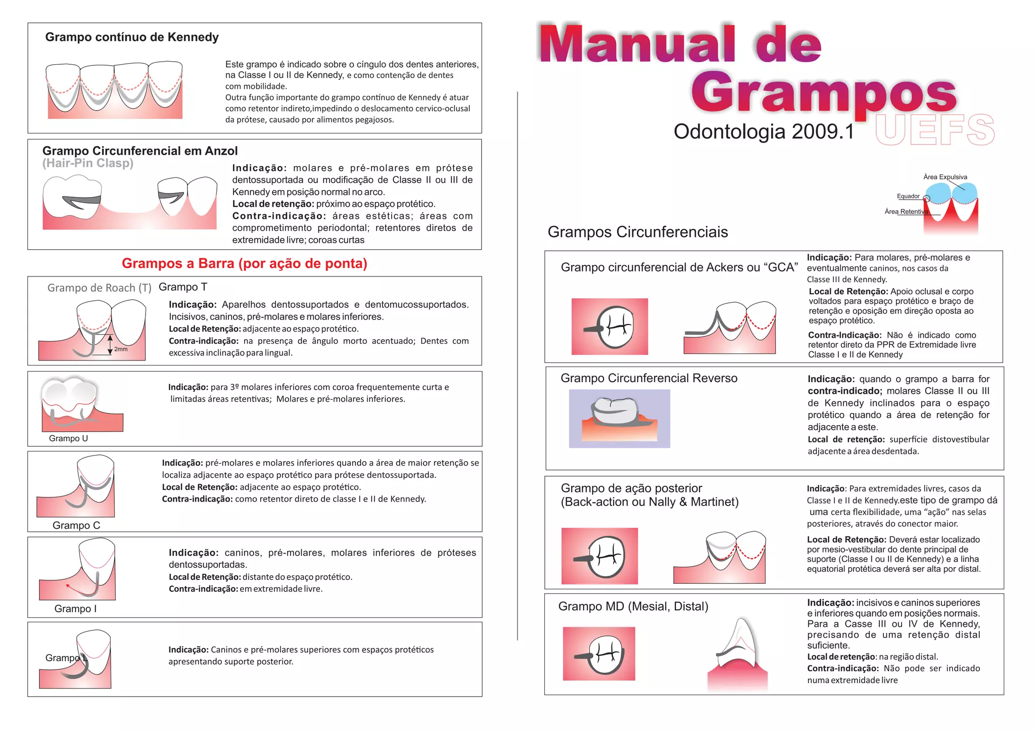 Grampos protese 1 pdf | PDF
