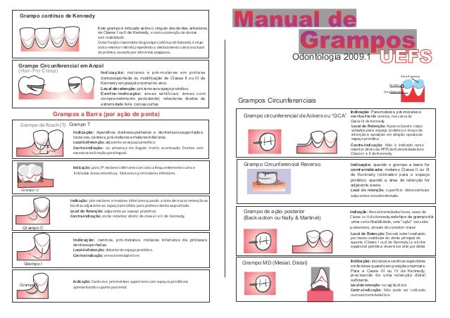 Grampos protese 1 pdf