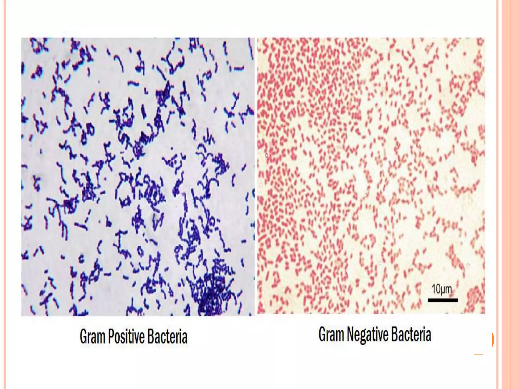 Gram’s staining | PPTX