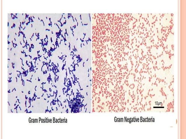 Gram’s staining | PPTX
