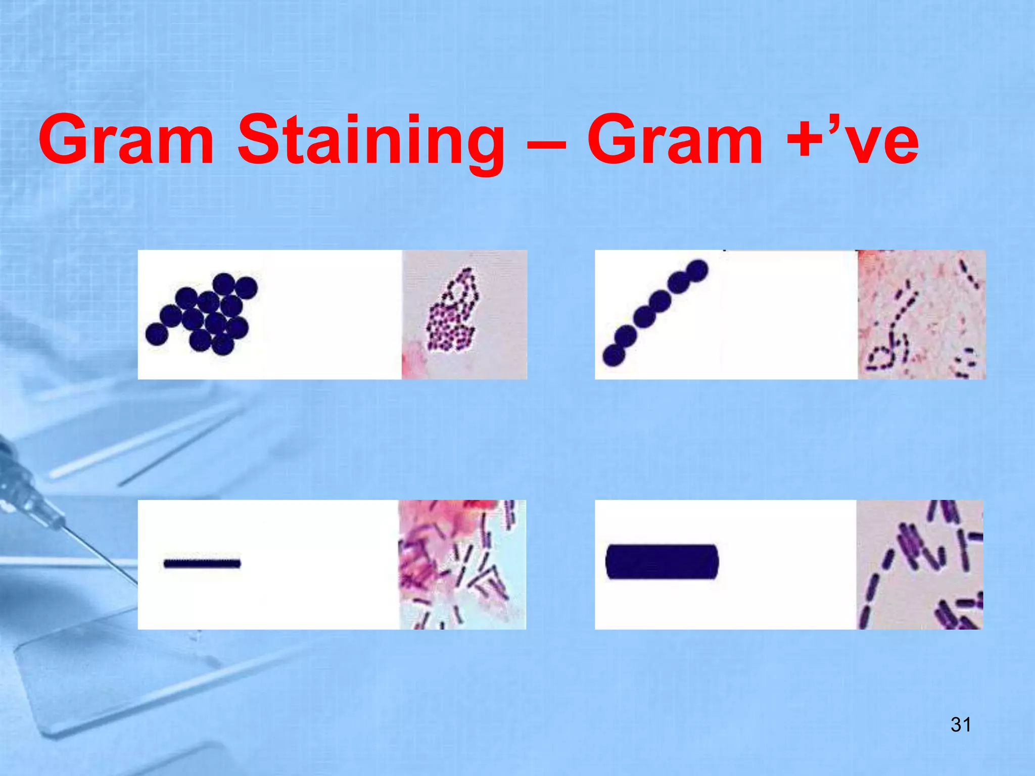 Gram’s Staining for medical students.pptx
