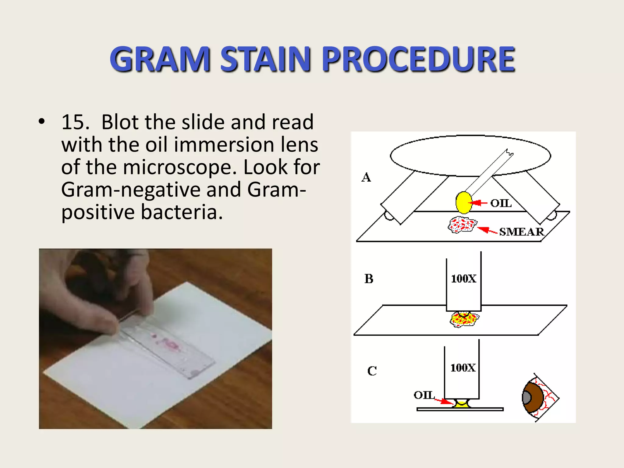 Grams staining and yoghurt making | PPTX